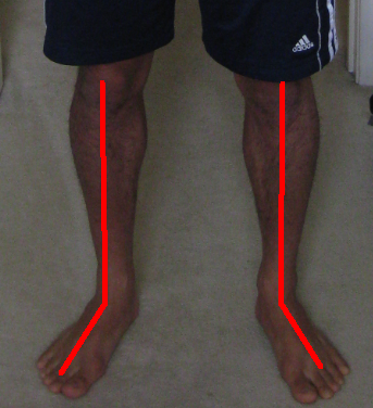 Tony Feet turned out with lines | b-reddy.org