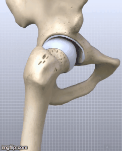 Femur and acetabulum GIF | b-reddy.org