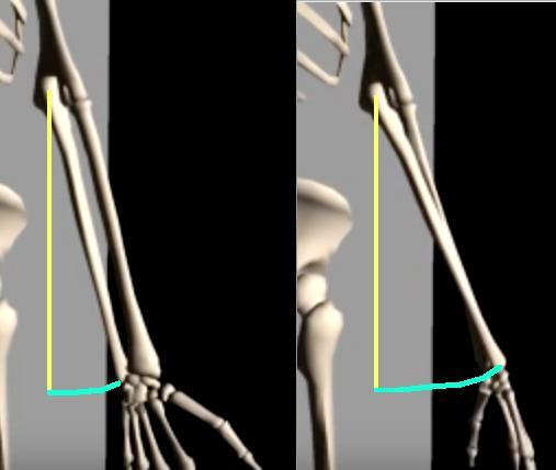 Ulna comparison forearm neutral to pronated | b-reddy.org