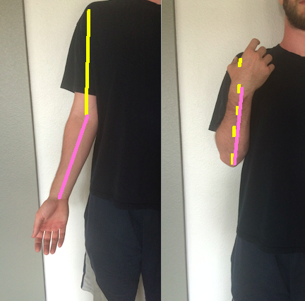 Alleviating Snapping Triceps and Ulnar Nerve Problems - b-reddy.org