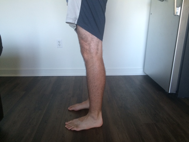 ACL Prevention and Rehab: The Other 23 Hours - b-reddy.org