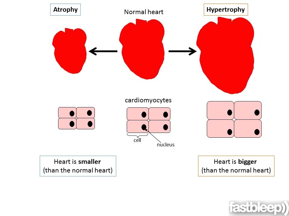 We shouldn’t view strength training as cardio | b-reddy.org